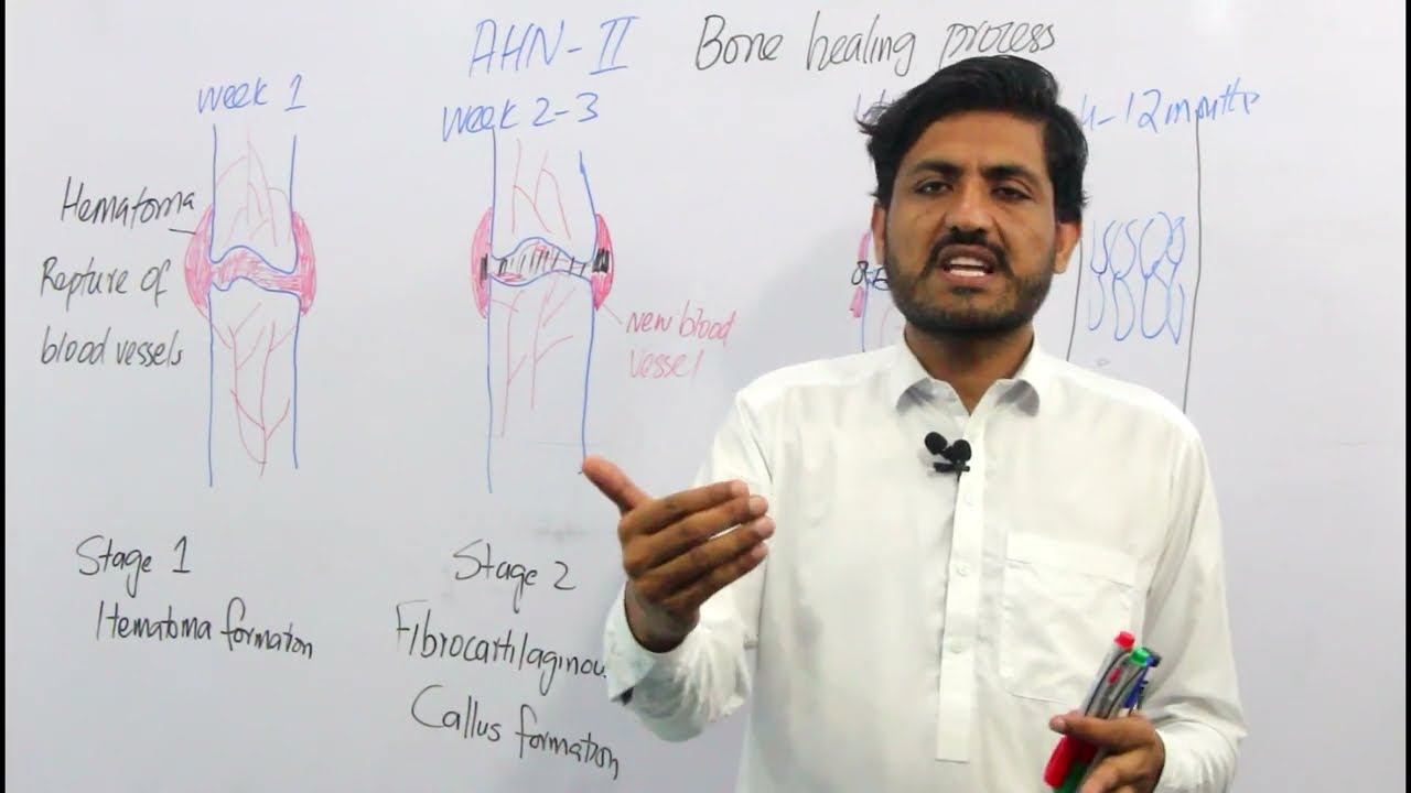 Bone Healing Process AHN-II Unit 1 I Bone remodeling I Fracture healing ...