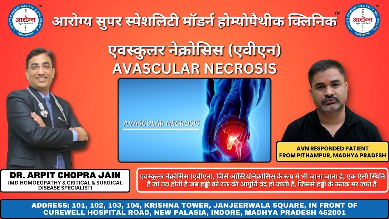 Avascular Necrosis Patient treated by Dr. Arpit Chopra Jain - YouTube
