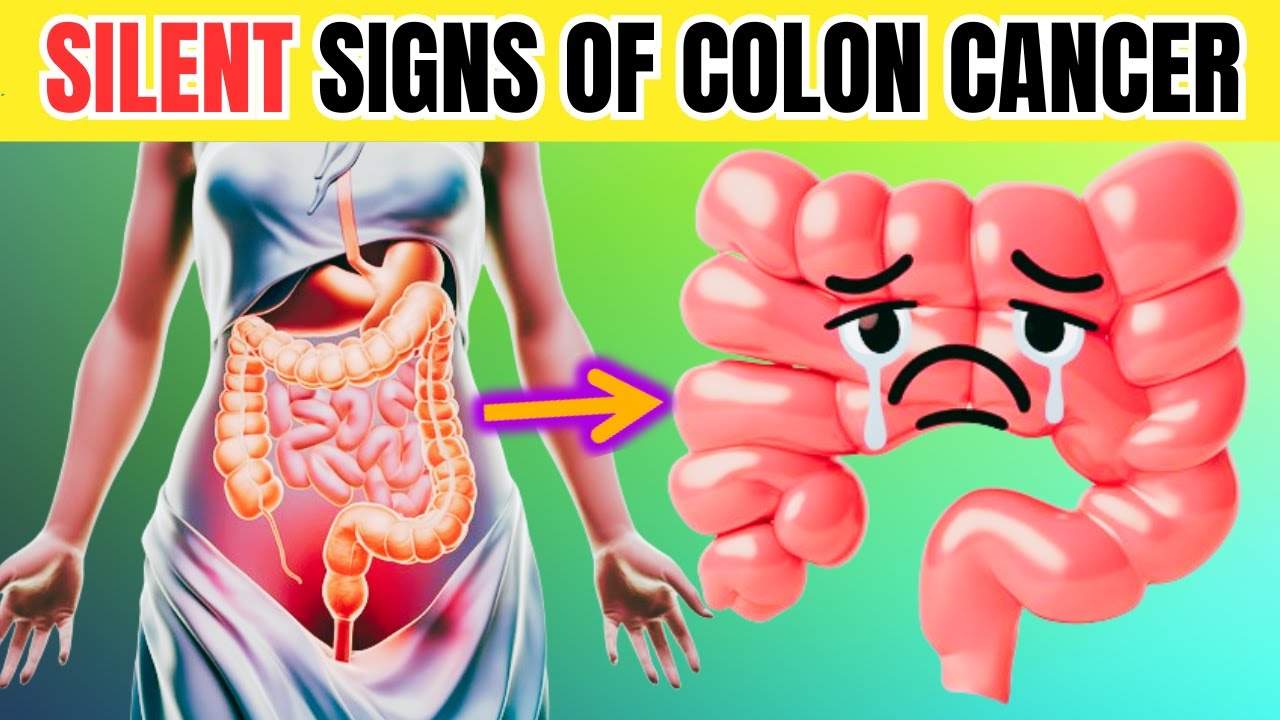 6 Silent Symptoms of Colon Cancer | Key Health - YouTube