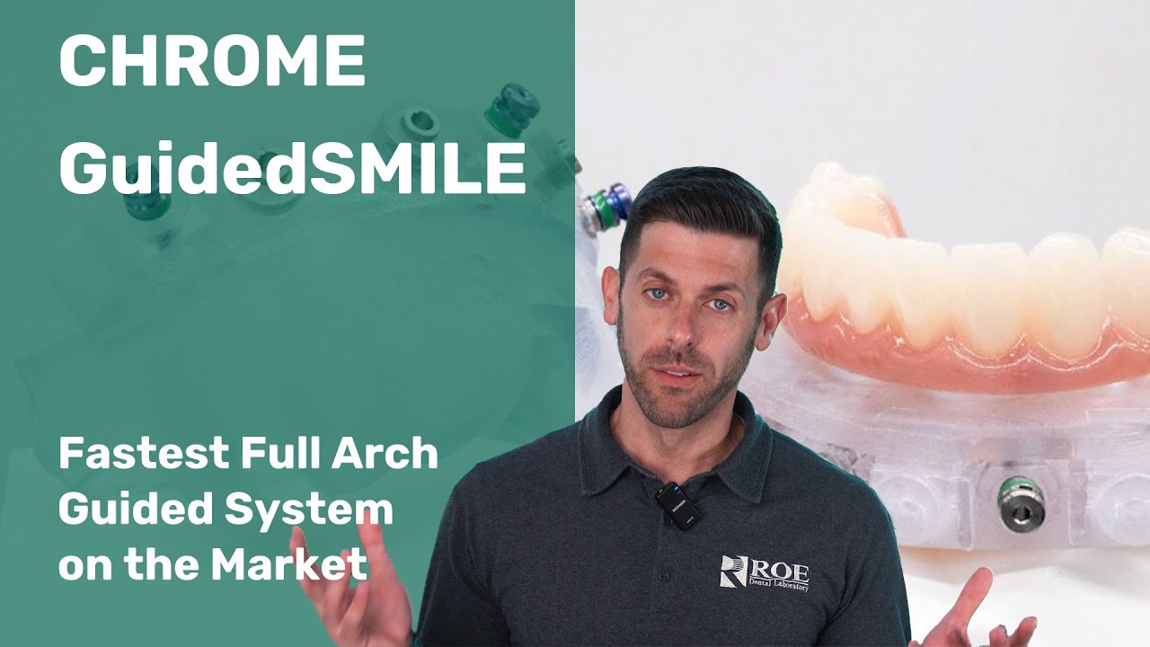 CHROME GuidedSMILE: Fastest Full Arch Guided System on the Market - YouTube