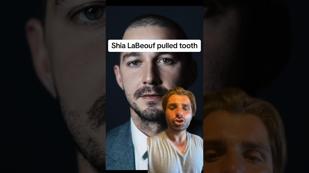 Shia LaBeouf pulled tooth - YouTube