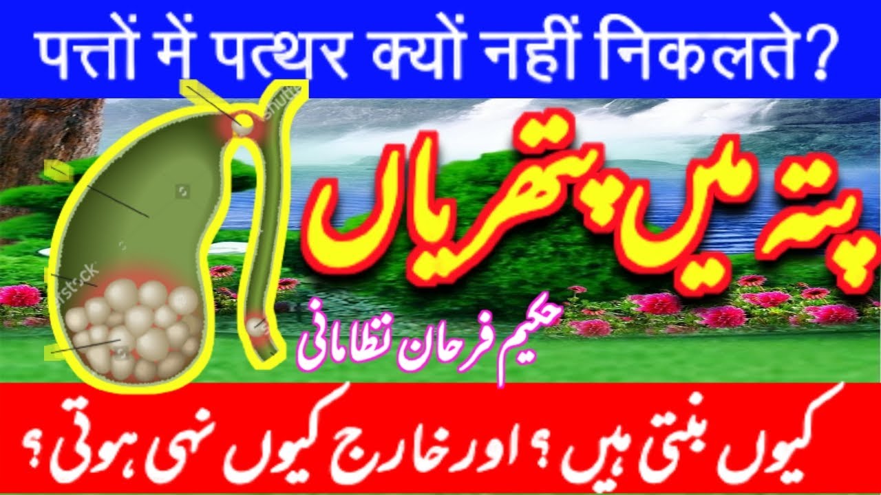 Gallbladder Stone treatment in Urdu || Pity ki pathri Ka ilaj || Hakeem ...