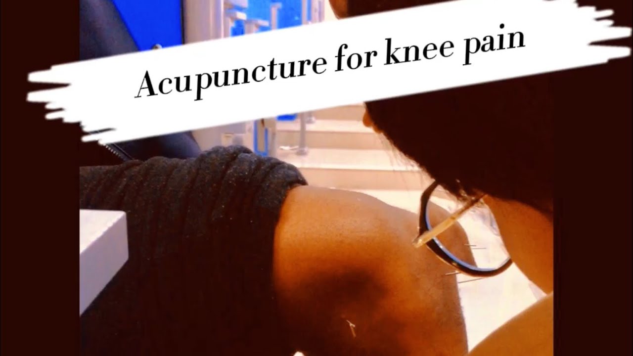 Acupuncture for knee pain#Chinese traditional medicine#TCM🇨🇳 - YouTube