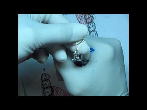 close protrusion wire bending - YouTube