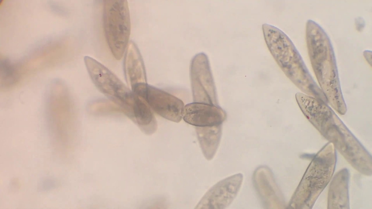 Paramecia, paramecium transverse division, Paramesyumda bölünme - YouTube