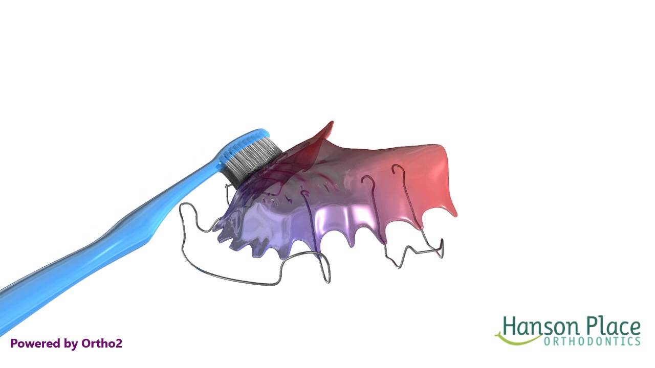 How to Care For Your Retainer - YouTube
