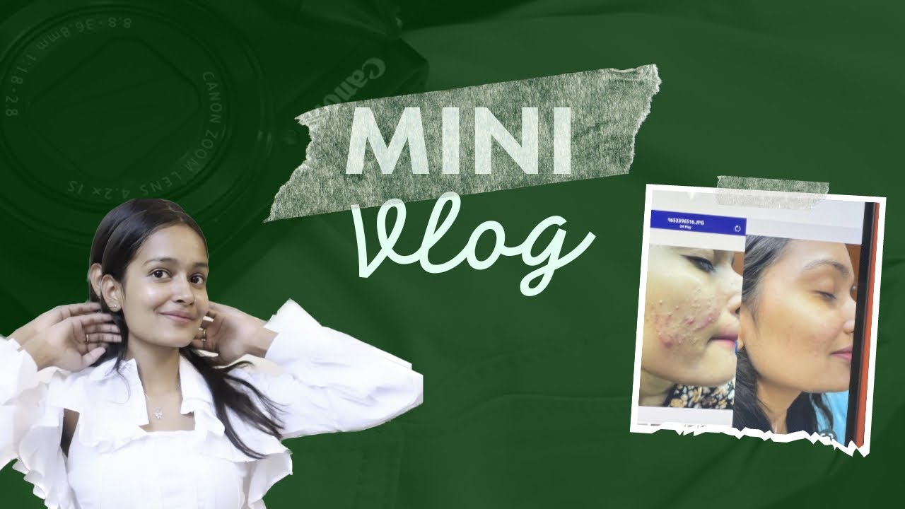 Random Mini Vlog | Colaba Market | Acne Issues - YouTube