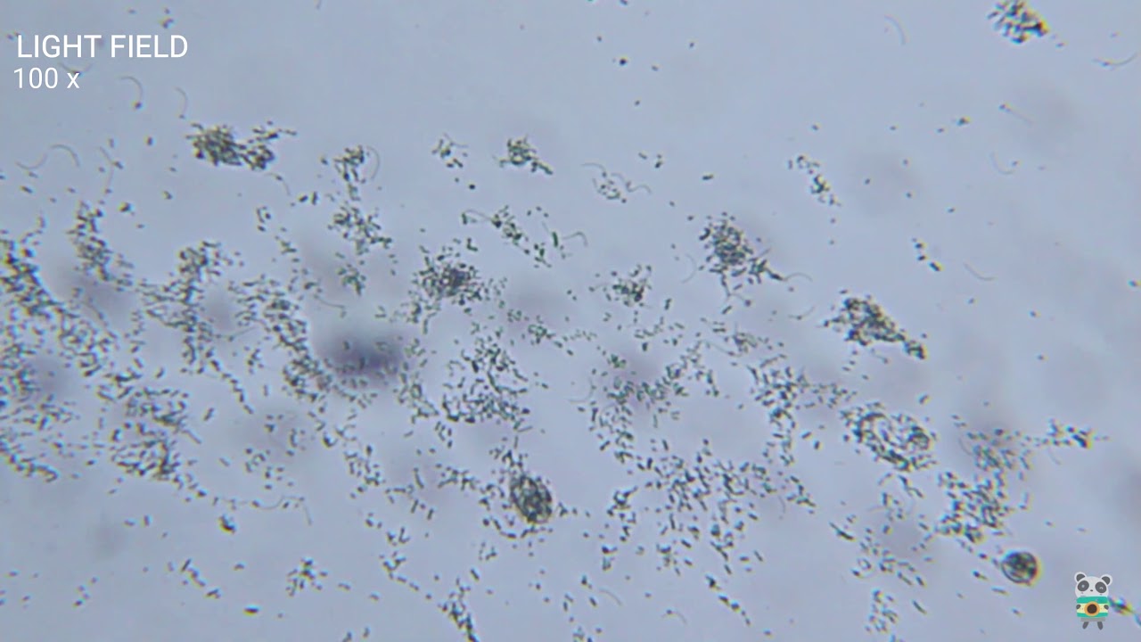 Alcohol vs Bacteria under the microscope - How many will stay alive ...