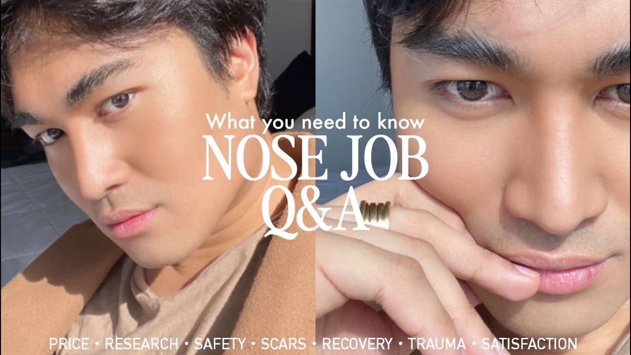 Filipino Nose Job Before And After 14 Young Filipino Stars Who Worked