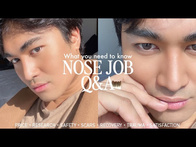 Wide Nose Rhinoplasty Filipino