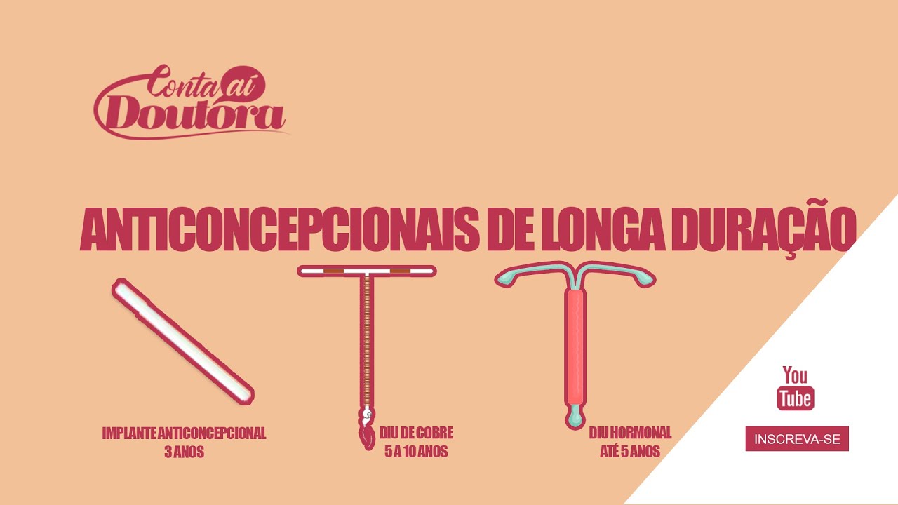 ANTICONCEPCIONAIS DE LONGA DURAÇÃO (LARC) - YouTube