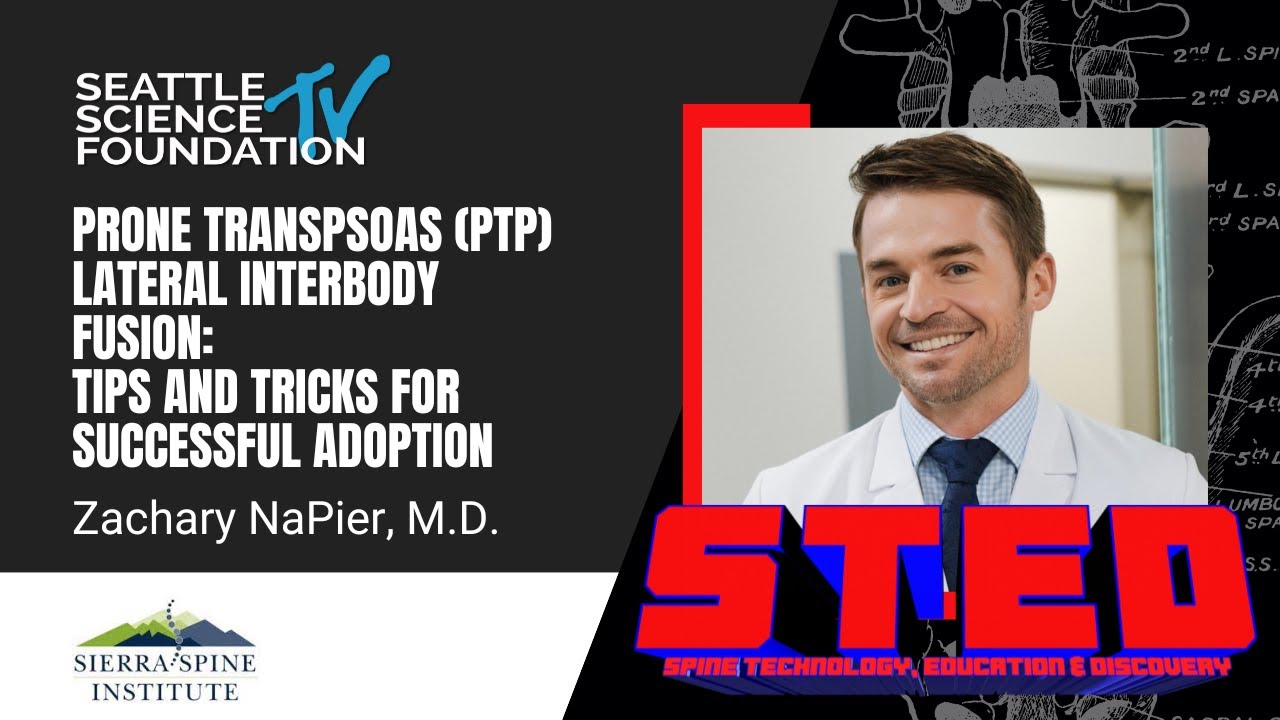 Prone Transpsoas (PTP) Lateral Interbody Fusion - Zachary NaPier, M.D ...