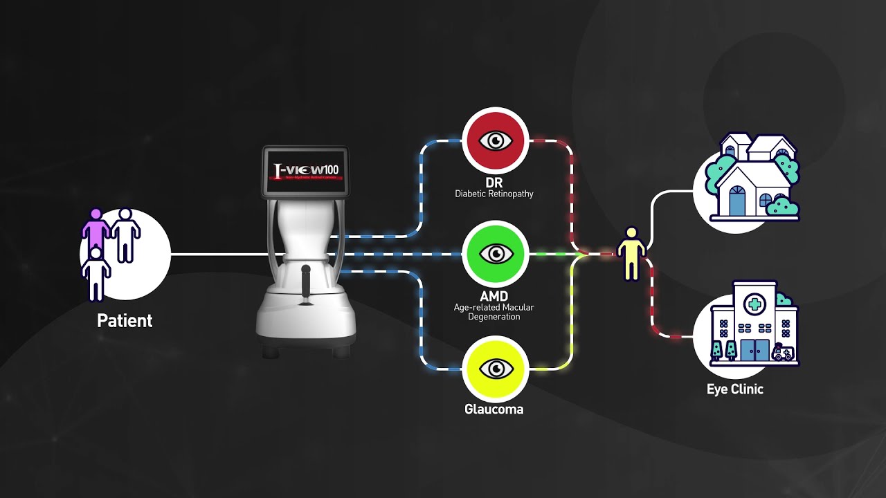 I-VIEW100 Product Introduction - YouTube