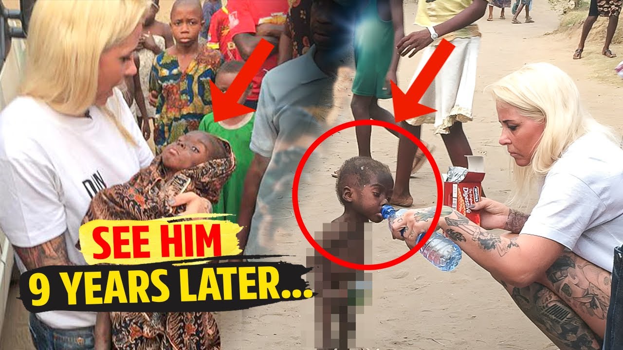 Remember The Abandoned Starving African Boy Who Went Viral 9 Years Ago ...