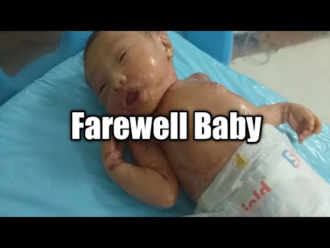 Collodian baby's Farewell - YouTube