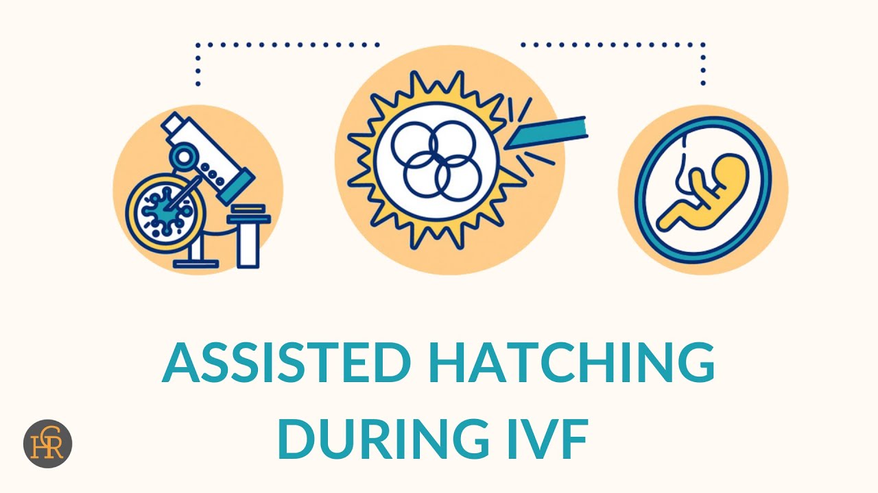 Assisted Hatching & IVF | Center for Human Reproduction - YouTube