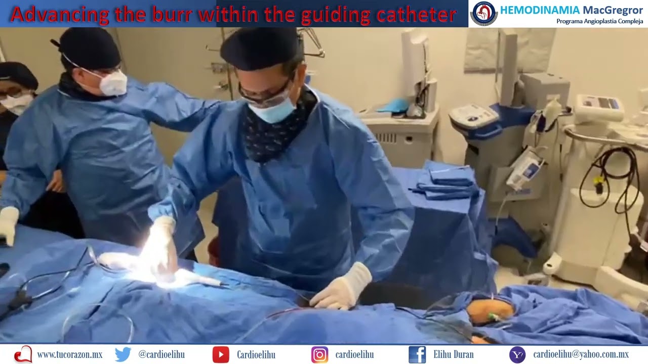 Rotablator Single Operator - YouTube