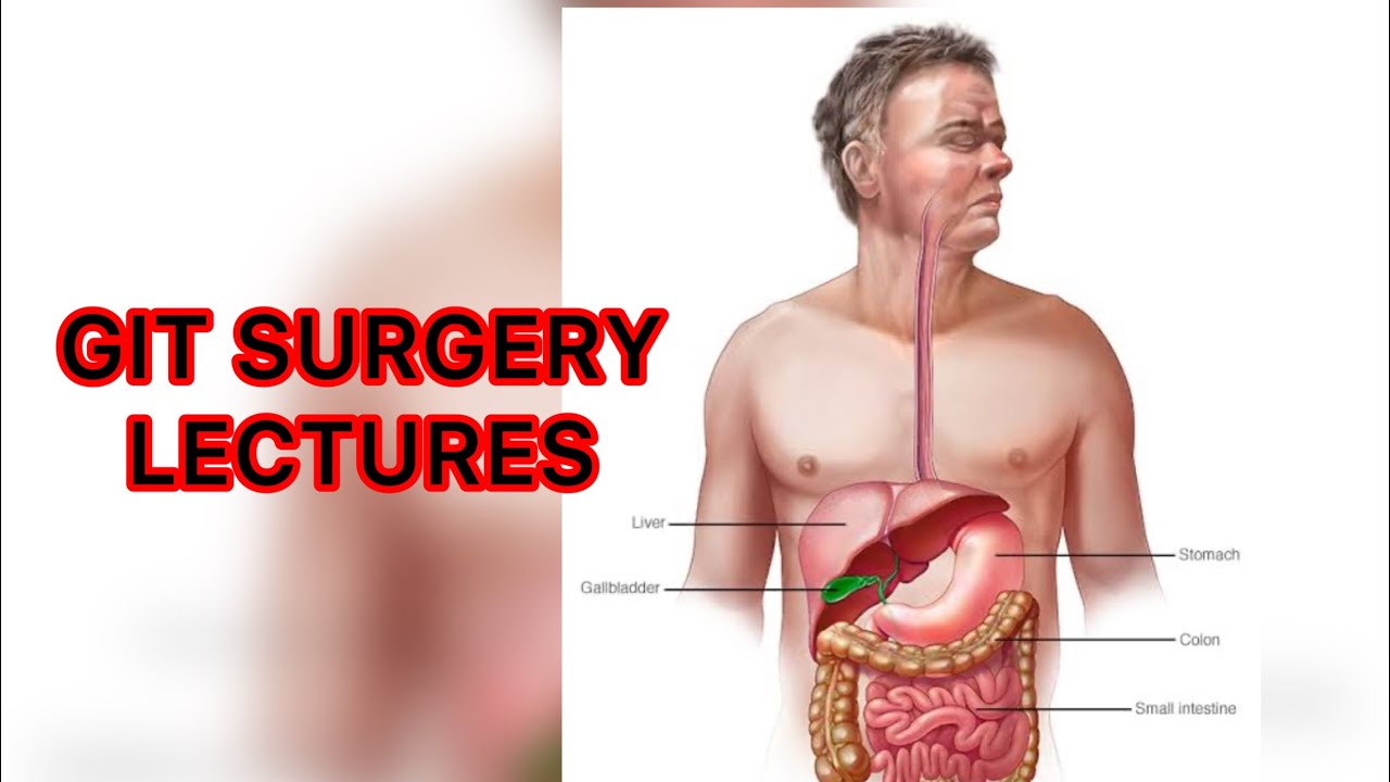 GIT SURGERY LECTURES part 6 , DIVERTICULA / ESOPHAGUS / surgery - YouTube