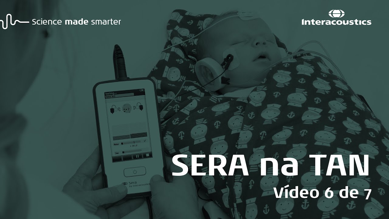 SERA na TAN 6x7 | Transferindo os exames - YouTube