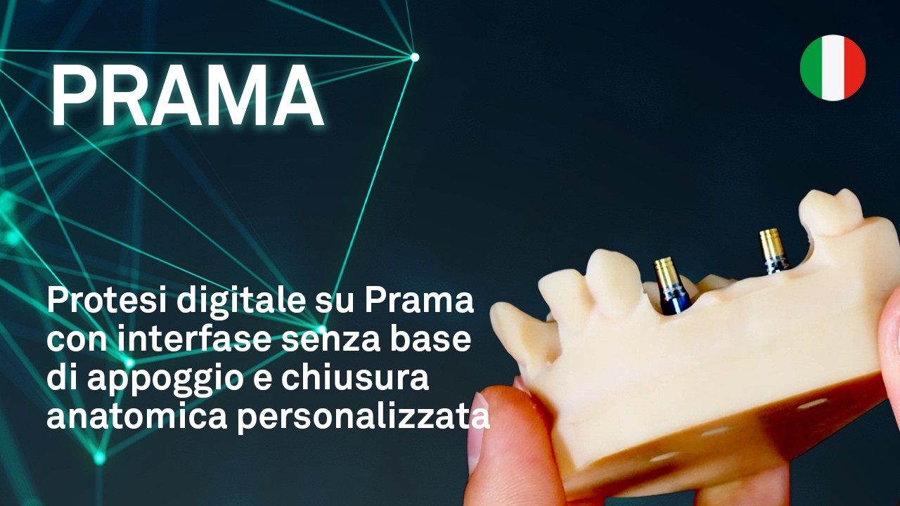 Protesi digitale su Prama con interfase senza base di appoggio e ...