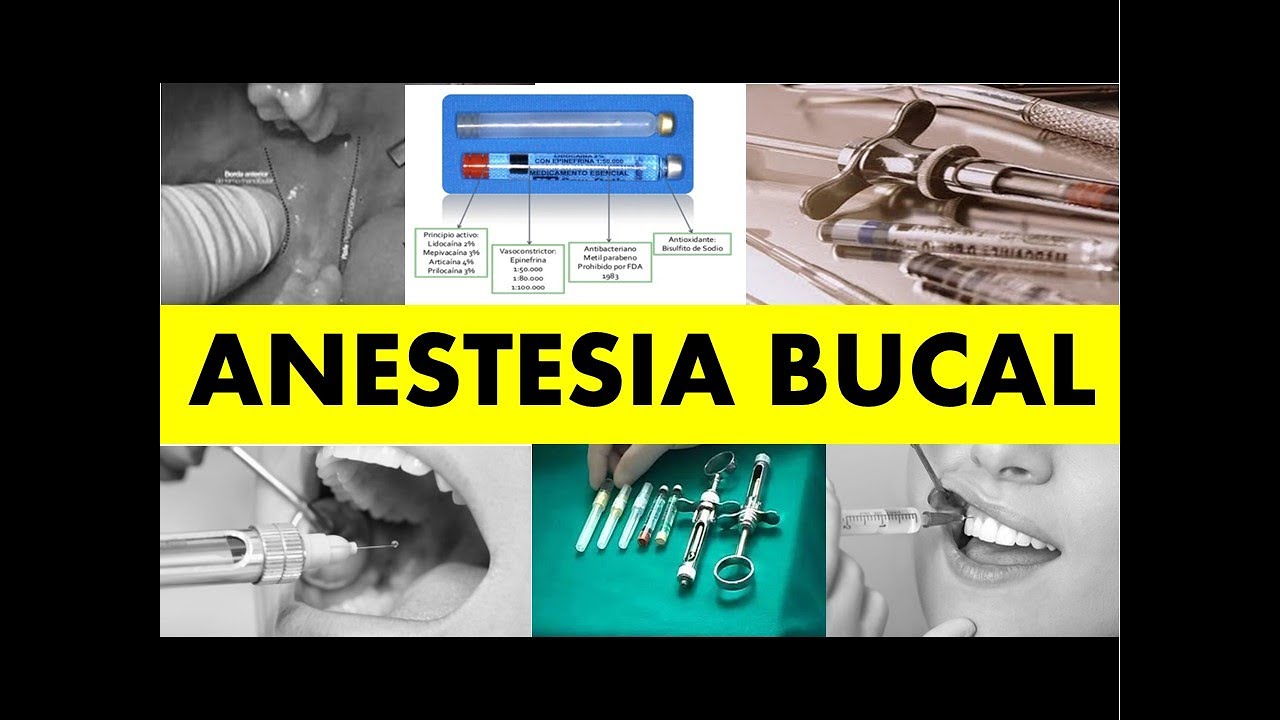 "ANESTESIA BUCAL, MANEJO BASICO Y TIPS" - YouTube