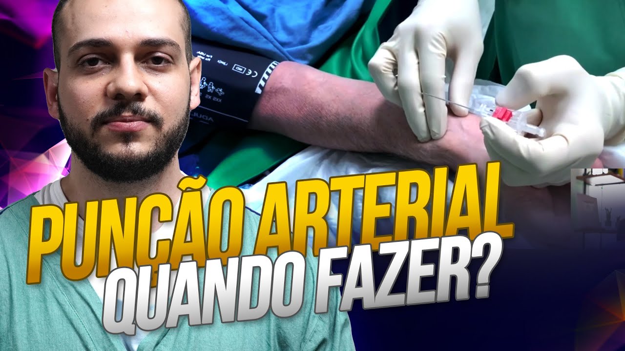 PUNÇÃO ARTERIAL: um dos jeitos certos de fazer - YouTube