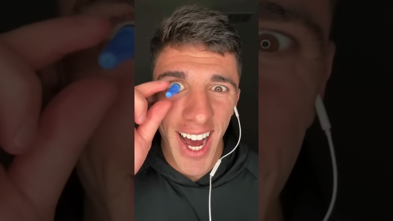 MY EYEBALL POPPED OUT 🙄 - YouTube