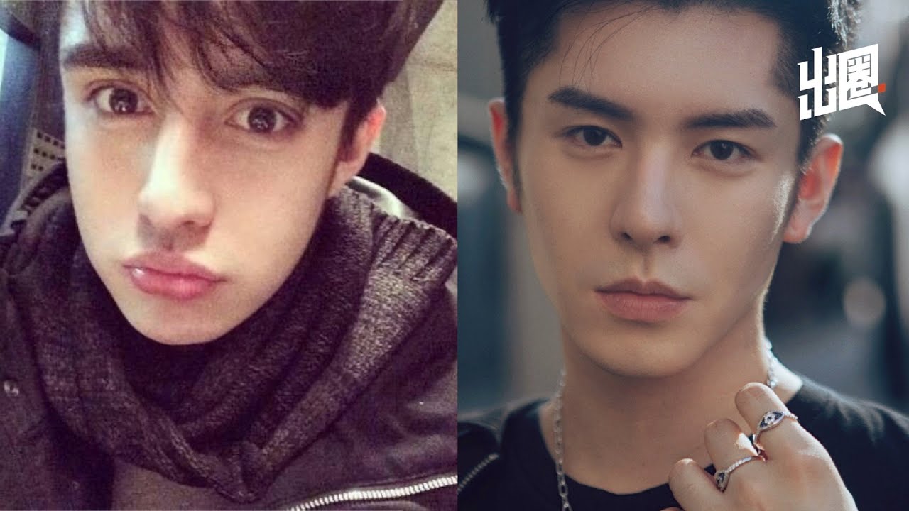 【出圈】林皓洋：一个男演员整容的十年 Lin Haoyang: An Actor Who Has Experienced Plastic ...