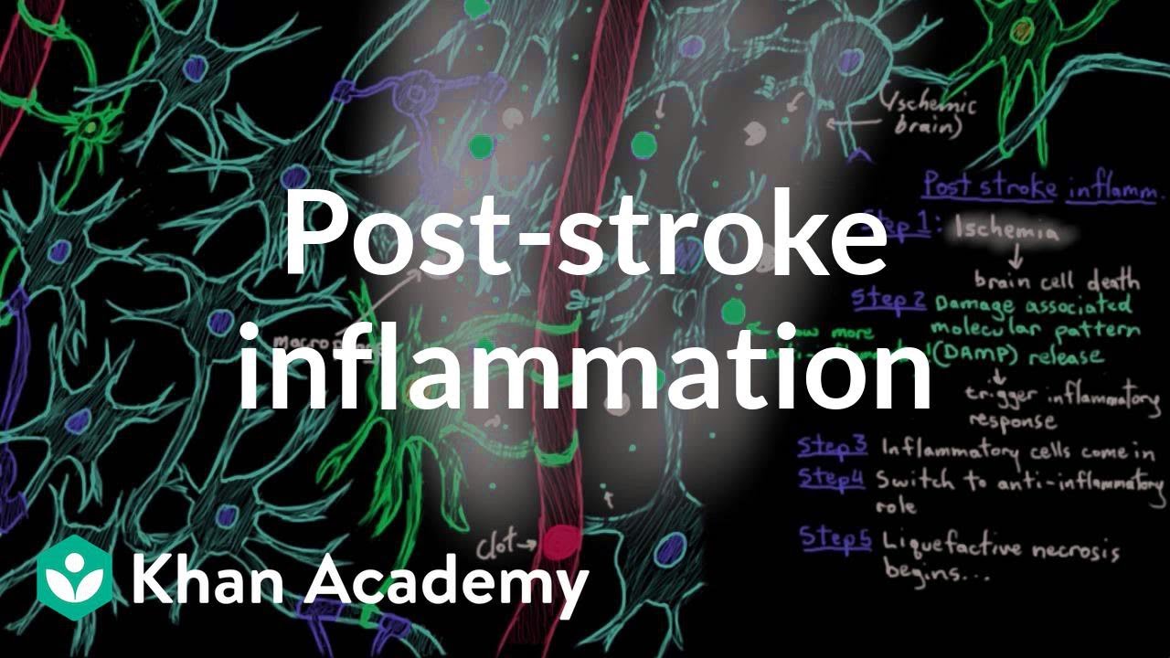 Post stroke inflammation | Circulatory System and Disease | NCLEX-RN ...