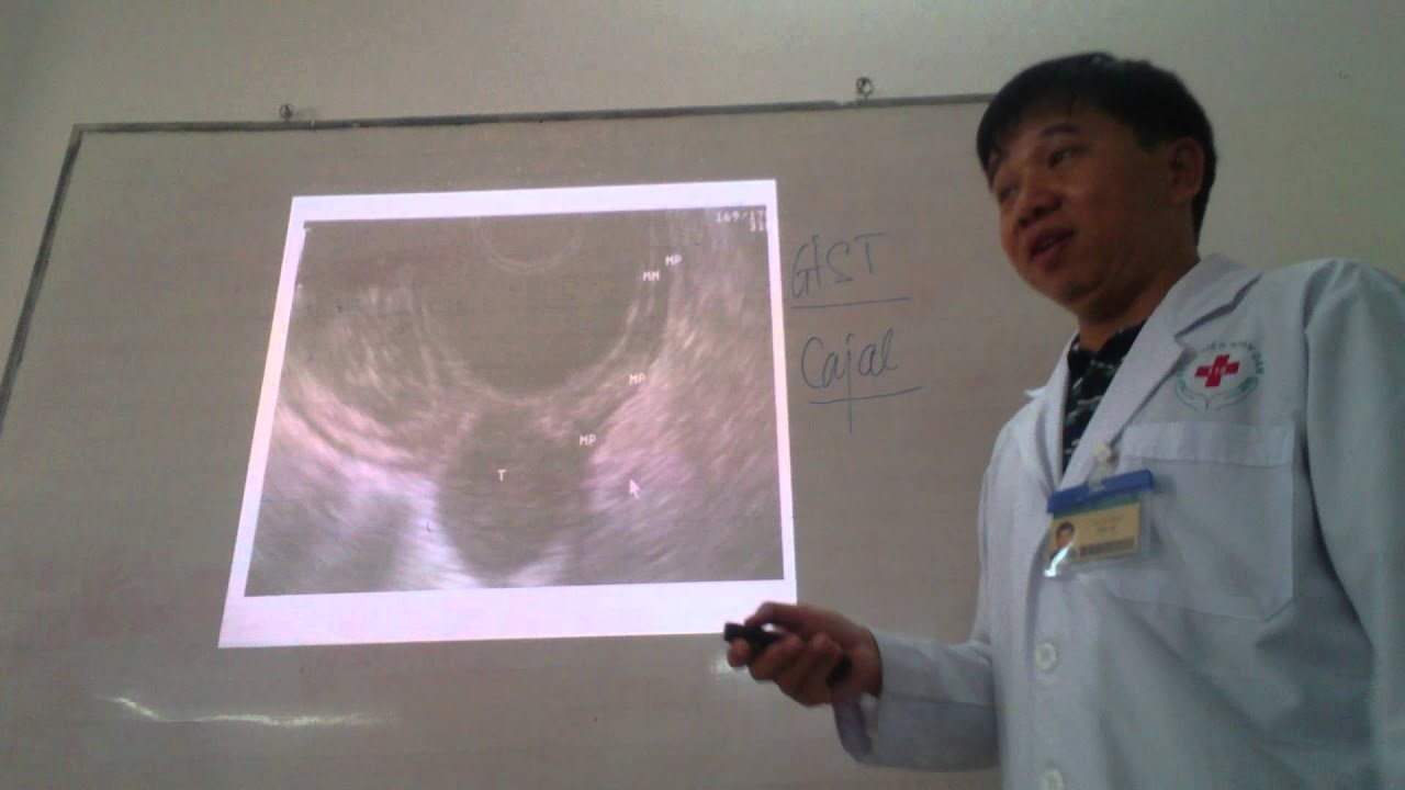 Hình ảnh học u GIST - YouTube