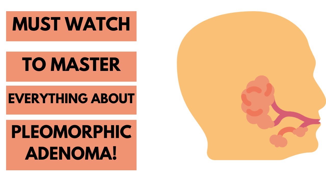 Mastering Pleomorphic Adenoma A Must Watch For Dentists And Dental