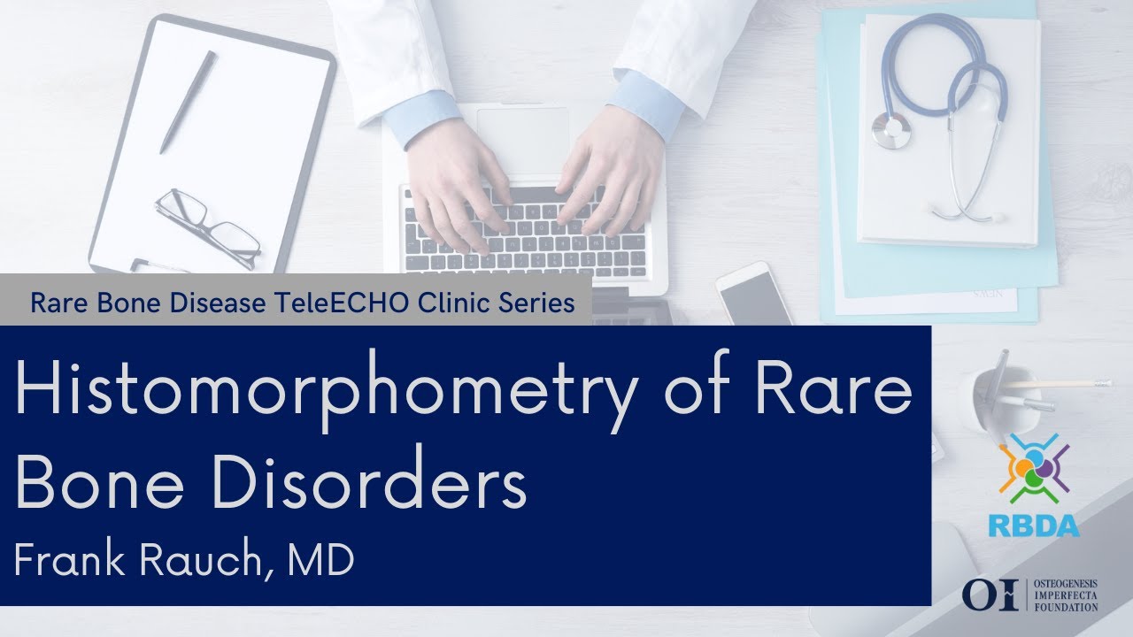 Histomorphometry of Rare Bone Disorders - YouTube