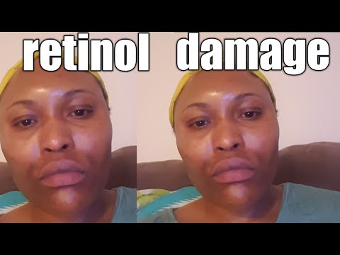 RETINOL DAMAGE|RETINOL RUINED MY FACE|SIDE EFFECTS OF USING RETINOL ...