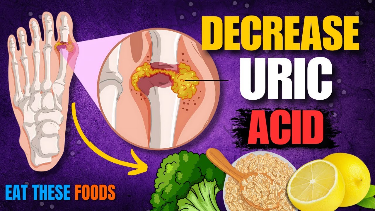 10 Best Foods to Lower High Uric Acid in the Blood | Best Vegetables ...