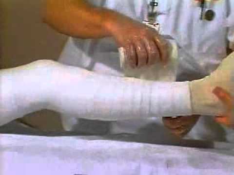 cylendrical cast - YouTube