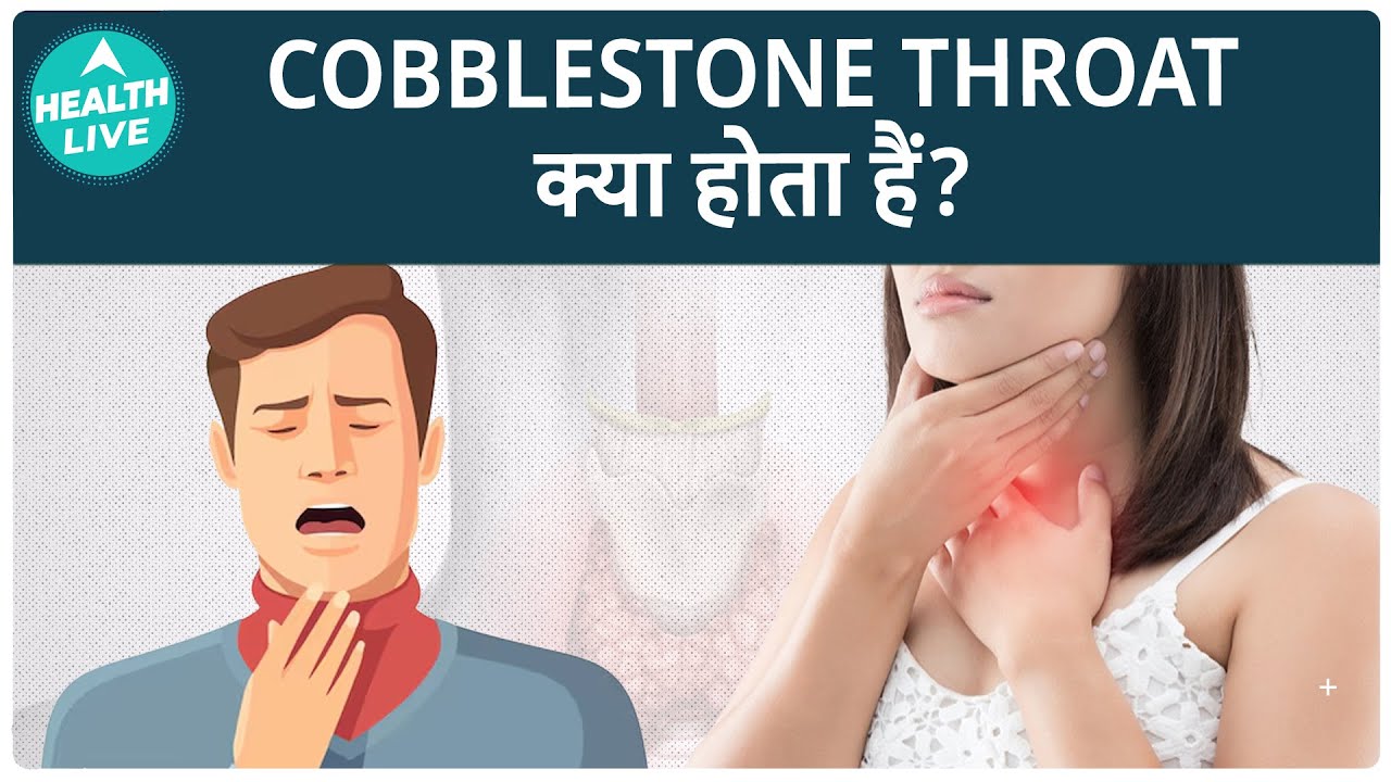 Cobblestone Throat Sore Throat On One Side: XR Causes And When To See