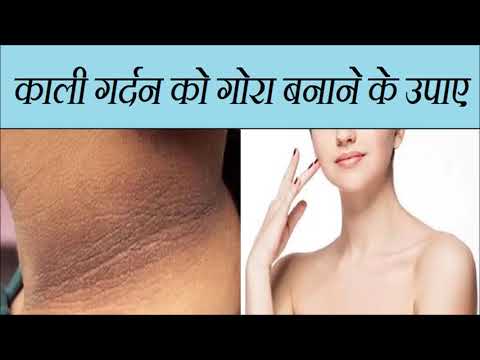 गर्दन का कालापन दूर करने के जबरदस्त तरीके /Ways to remove neck blackness