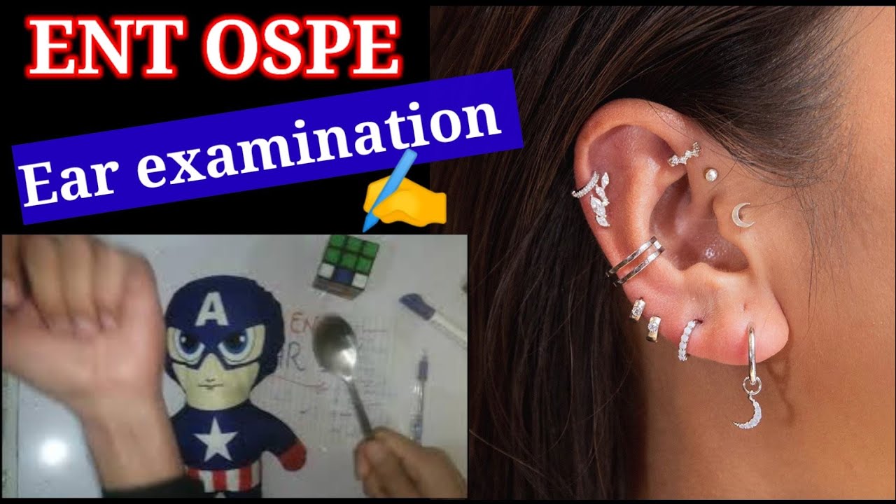 EAR EXAMINATION ENT. 🔴#ospe #ent #ear #rinne #weber test. #examination ...