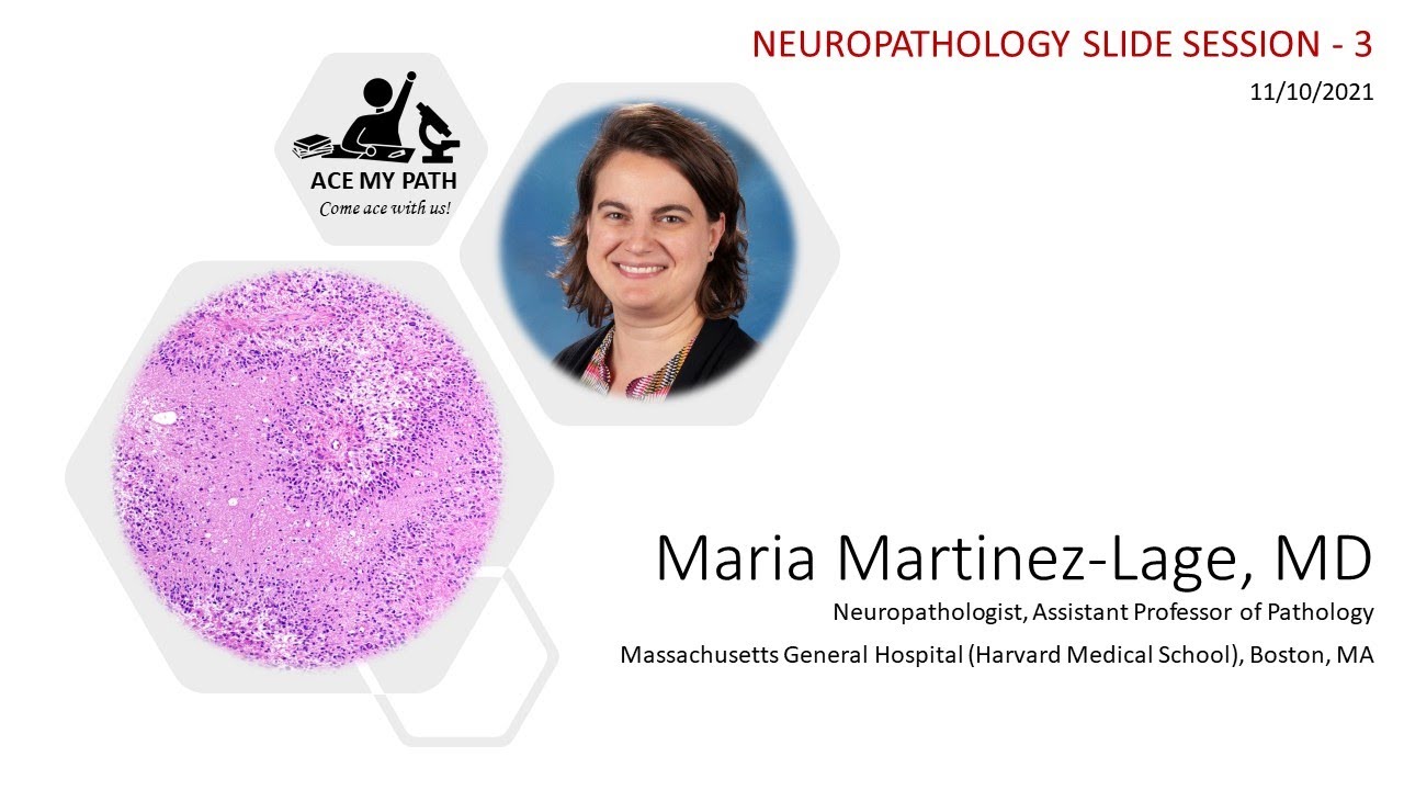 Day 20: Neuro 3: Dr. Maria Martinez - Lage, MD (Mass General, Harvard ...