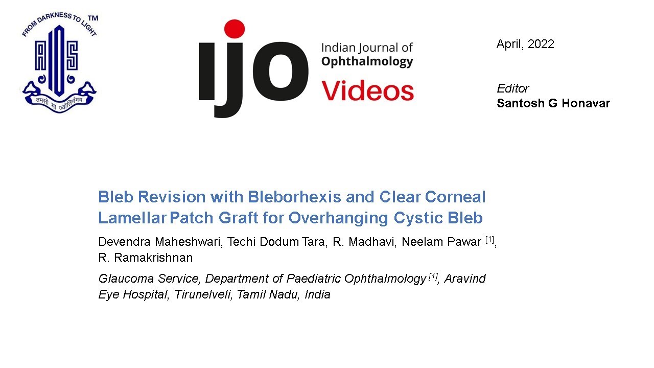 Bleb Revision with Bleborhexis and Clear Corneal Lamellar Patch Graft ...