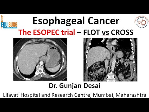 ESOPEC, CheckMate 577, and Neo-AEGIS: Breakthroughs in Esophageal ...