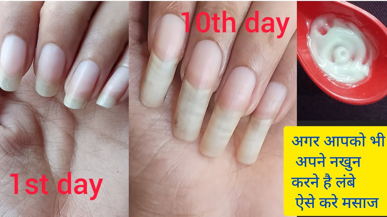 How To Grow Nails Fast In One Week || Diy Nails Growth Cream || नखुनो ...
