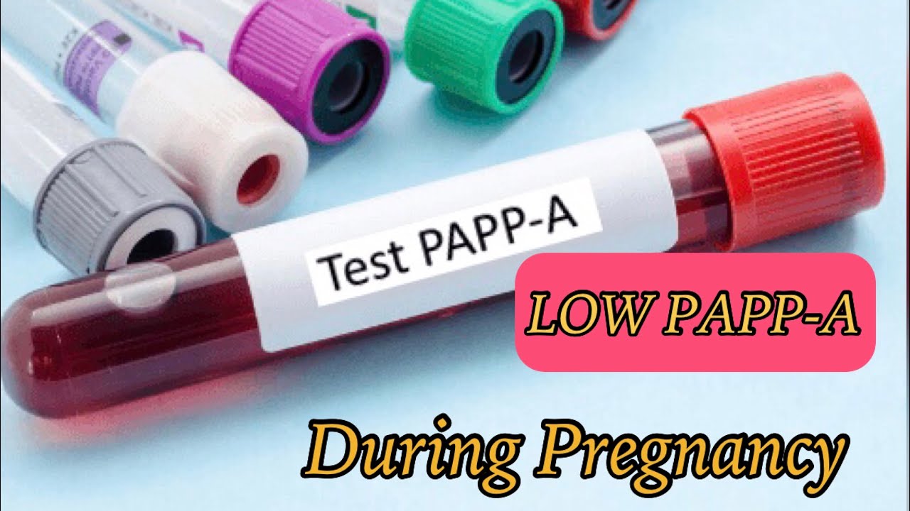 PAPP-A Test During pregnancy🤰🏻 In Tamil - YouTube