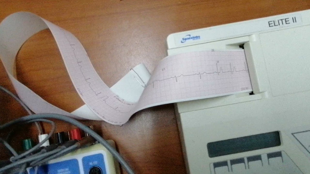 EKG Burdick Elite II uso básico - YouTube