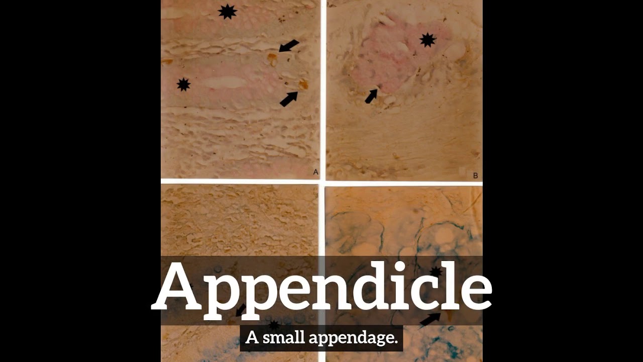 How to Say Appendicle in English? | What is Appendicle? | How Does ...