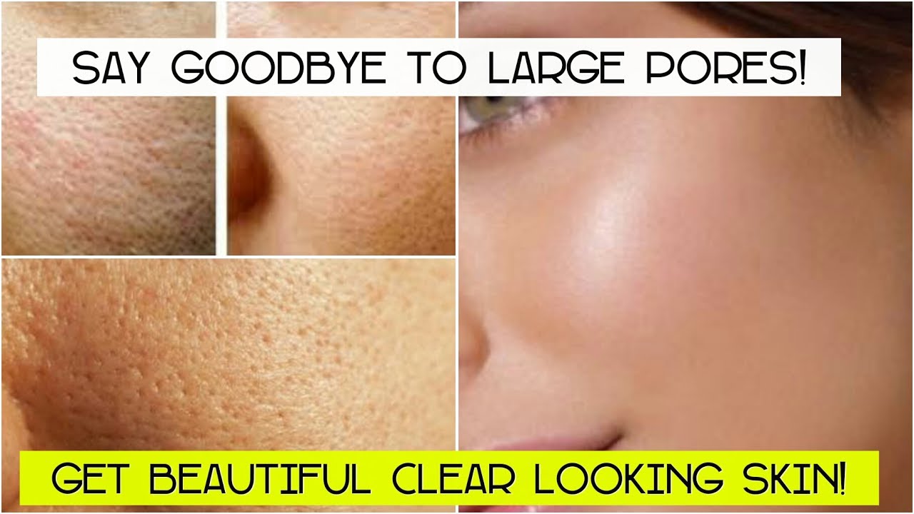Minimise Your Large Open Visible Pores - DIY Treatment at home to ...