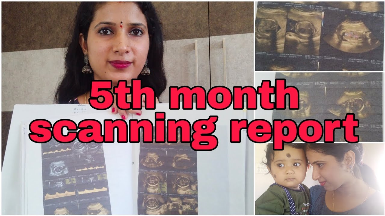 5th month scanning report/ anamoly scan// my scanning experience/ baby ...
