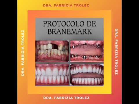 protocolo de Branemark - YouTube