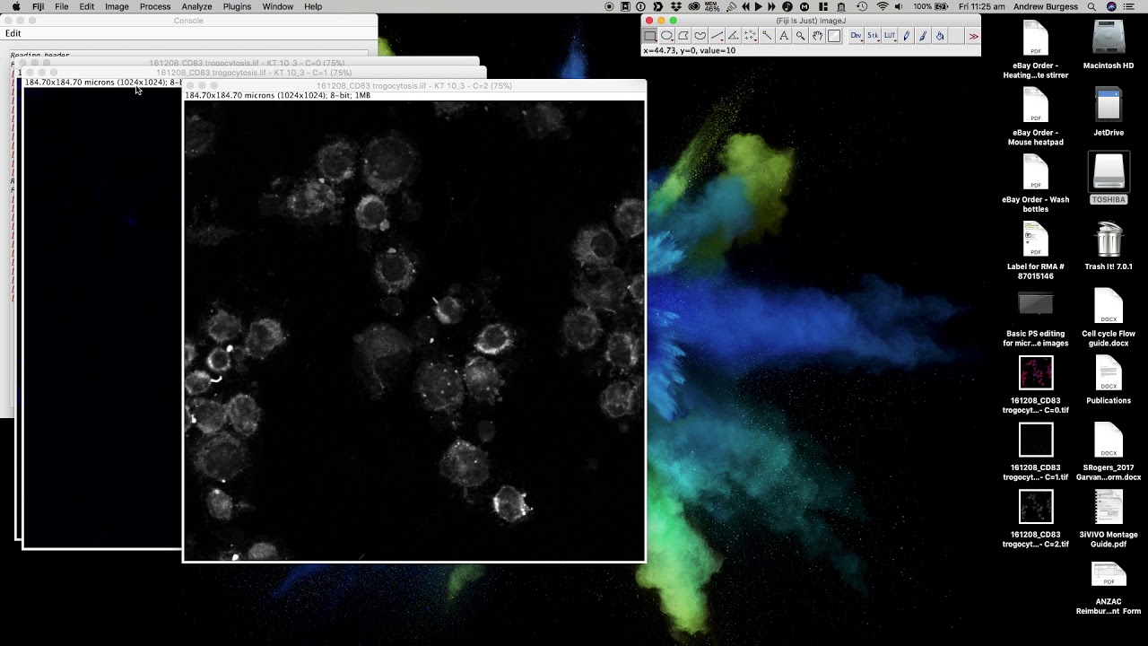 Adding A Scale Bar Imagej Fiji Youtube