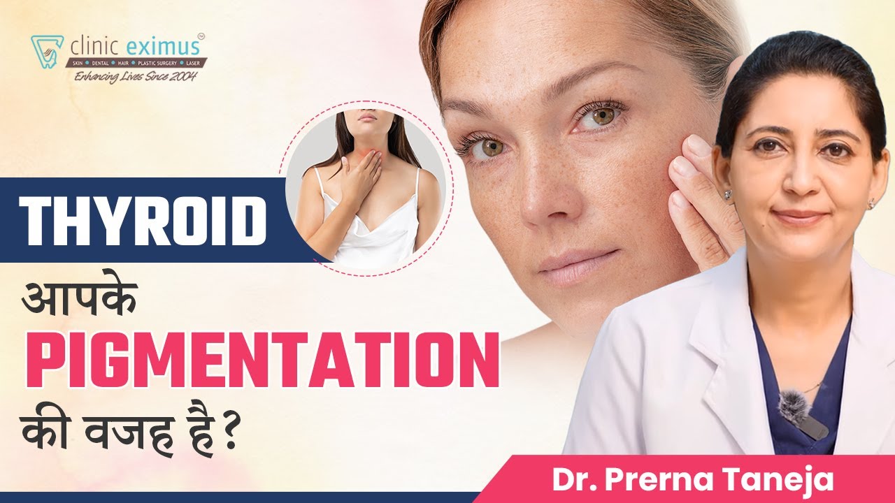 Thyroid आपके Pigmentation की वजह है? | How Thyroid Affects Your Skin ...